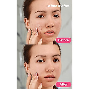 DERMALOGY by NEOGENLAB A-CLEAR SOOTHING ACNE CARE (4 PACK)