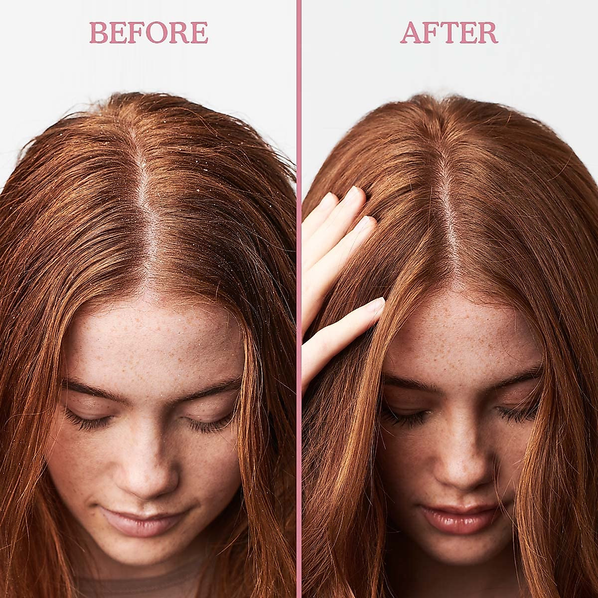 Umberto Giannini Scalp Restore Balancing Conditioner, Vegan & Cruelty Free Scalp Reviving Formula with Coconut Oil & Vitamin E, 8.5fl Oz