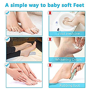Foot Peel Mask-3 Pack,Foot Exfoliating Set With Milk Serum,Baby Foot Peeling-Cracked Feet Treatment,Dead Skin Heel Scraper For Feet,Disposabel Feet Spa Socks,Intensly Moisturizes Repair and Softens The Feet