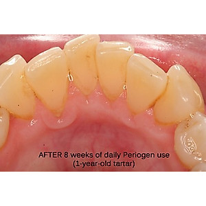 Periogen Complete Oral Health Rinse (3-PK)