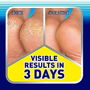 Scholl Cracked Heel Repair Cream Active Repair K+ Visible Results In 3 Days 60ml