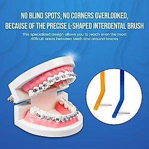 AIM DENTAL SUPPLY Toothbrush for Braces, Soft Head Braces Toothbrush, V Trimmed Design 2-Pack | Quick Orthodontic Cleaning | Deep Clean Braces at Home (Pack of 2)