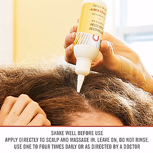 First Aid Beauty FAB Anti-Dandruff Scalp Treatment – Fights Dandruff, Instantly Soothes Dry Scalp – 3 oz