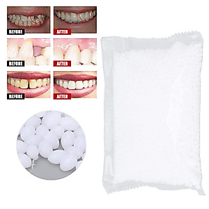 100g Moldable Thermal Fitting Bead, Temporary Tooth Filling Repair Accessory for Halloween Party Teeth Replacement Kit Restoration