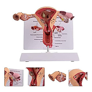 ROLTIN Human Pathological Uterus Model Internal Reproductive System Organ Anatomical Model Human Anatomy Model for Medical Training Aid