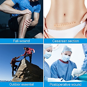 Large Butterfly Bandaids, Steri Strips Wound Closure, Emergency Wound Closure Device Surgical Laceration Repair without Stitches for Extra Large Wound Care, Ahead Be Prepared (PU)