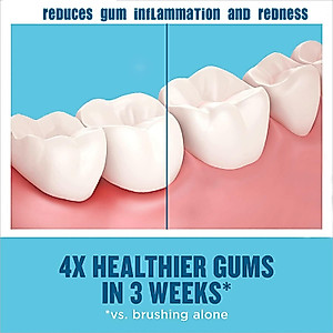 3PCs Teeth Whitening Mouthwash, Calculus Removal, Healing Mouth Ulcers, Eliminating Bad Breath, Prevents and Treats Cavities,Tooth Regeneration(50ml)