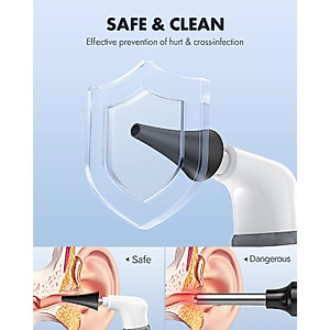 Anykit Wireless Otoscope Ear Camera with Dual View, 3.9mm 720PHD WiFi Ear Scope with Ear Wax Removal Tool for Kids and Adults & Pets, Compatible with Android and iPhone