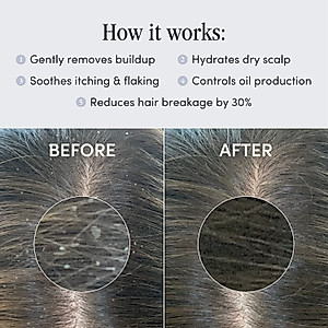 Jupiter Dandruff Shampoo, Conditioner, and Serum Trio, Relieves Itchy, Dry, & Flaky Scalp, Color-Safe, & Sulfate-Free, Made with Zinc, Coconut Oil, and Green Tea