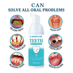 3PCs Teeth Whitening Mouthwash, Calculus Removal, Healing Mouth Ulcers, Eliminating Bad Breath, Prevents and Treats Cavities,Tooth Regeneration(50ml)