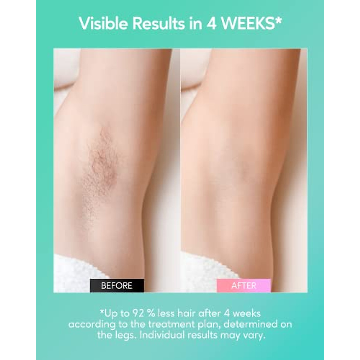 INNZA IPL Hair Removal Device for Women and Men at Home,Permanent Hair Remover Machine with 1 Attachment,10 Energy Levels,24J High Energy Hair Removal Handset for Face Bikini Line Armpit Back,Corded