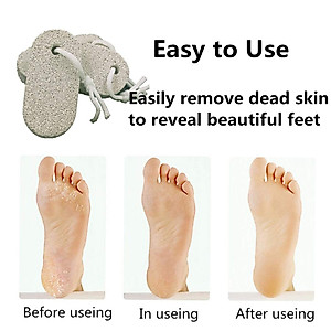 ZHome Natural Pumice Stone for Feet, Phogary Lava Pedicure Tools Hard Skin Callus Remover for Feet and Hands 2PCS