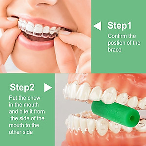 BVN Aligner Chewies, 10 Pieces Orthodontic Chewies, Retainer Chewies, Dental Chewies for Aligners, Orthodontic Dental Chewies Munchies, Green