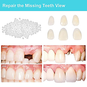 Brige Tooth Repair kit for Filling The Missing Broken Tooth and Gaps-Moldable Fake Teeth and Thermal Beads Replacement Kit