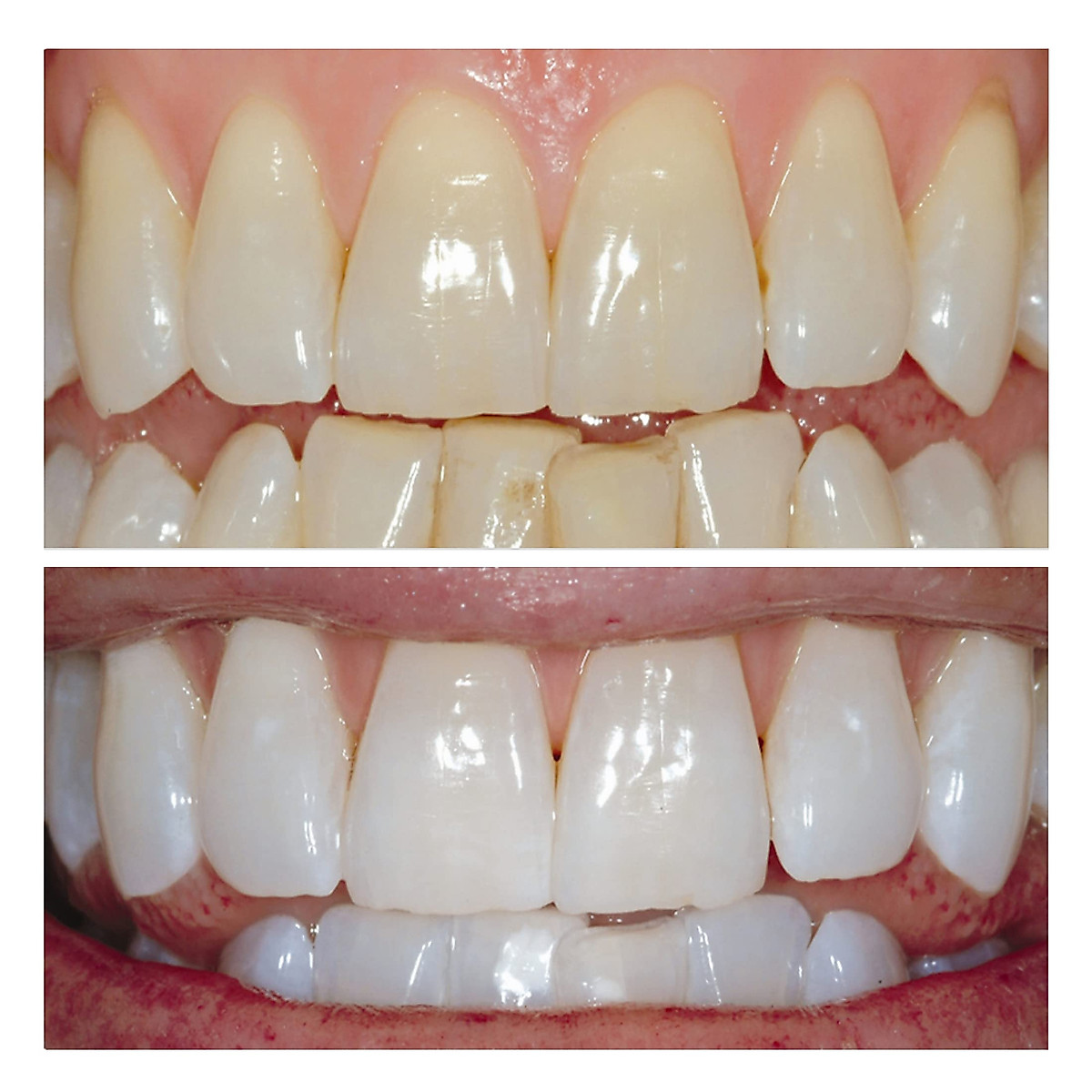 Vibe Teeth Whitening Pens, Healthy, Peroxide Free 4 Pack, Non-Toxic Fast Results, 3ml per pen, Vegan, Painless, teeth whitening kit for sensitive teeth, Travel Sized, Easy to Use, Organic Mint Flavor