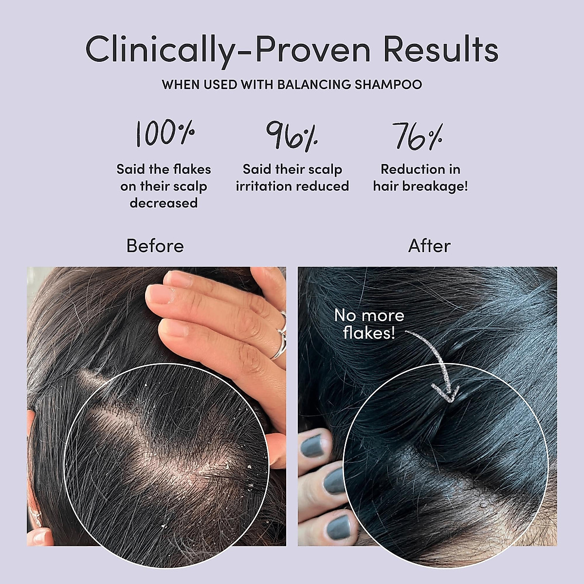 Jupiter, Physician-Formulated Scalp Balancing Conditioner for Dry, Itchy, Oily, Flaky Scalp, Sulfate-Free, Natural Fragrance, Vegan, Color-Safe, & Paraben-Free Conditioner for Women & Men