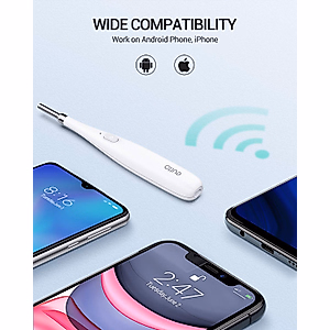 eutto Wireless Otoscope with Gyroscope, 0.15in Probe HD Ear Camera, 6 LED Lights, Ear Inspection Camera, Ear Wax Removal Tools, Compatible with iPhone and Android