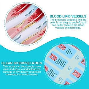 Human Body Skeleton Anatomical Model Low- Density Lipoprotein Blood Vessel Model
