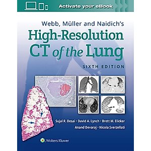 Webb, Müller and Naidich's High-Resolution CT of the Lung