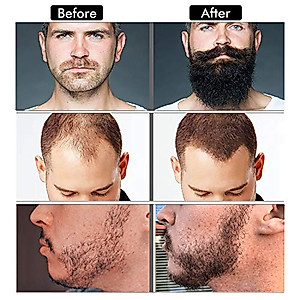 Beard Growth Kit - Derma Roller for Beard Growth, Beard Growth Serum Oil (2oz), Beard Balm and Comb, Stimulate Beard and Hair Growth - Gifts for Men Dad Him Boyfriend Husband Brother