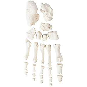 Wellden Medical Full Disarticulated Skeleton, Human Anatomical, Life-Size, 170cm