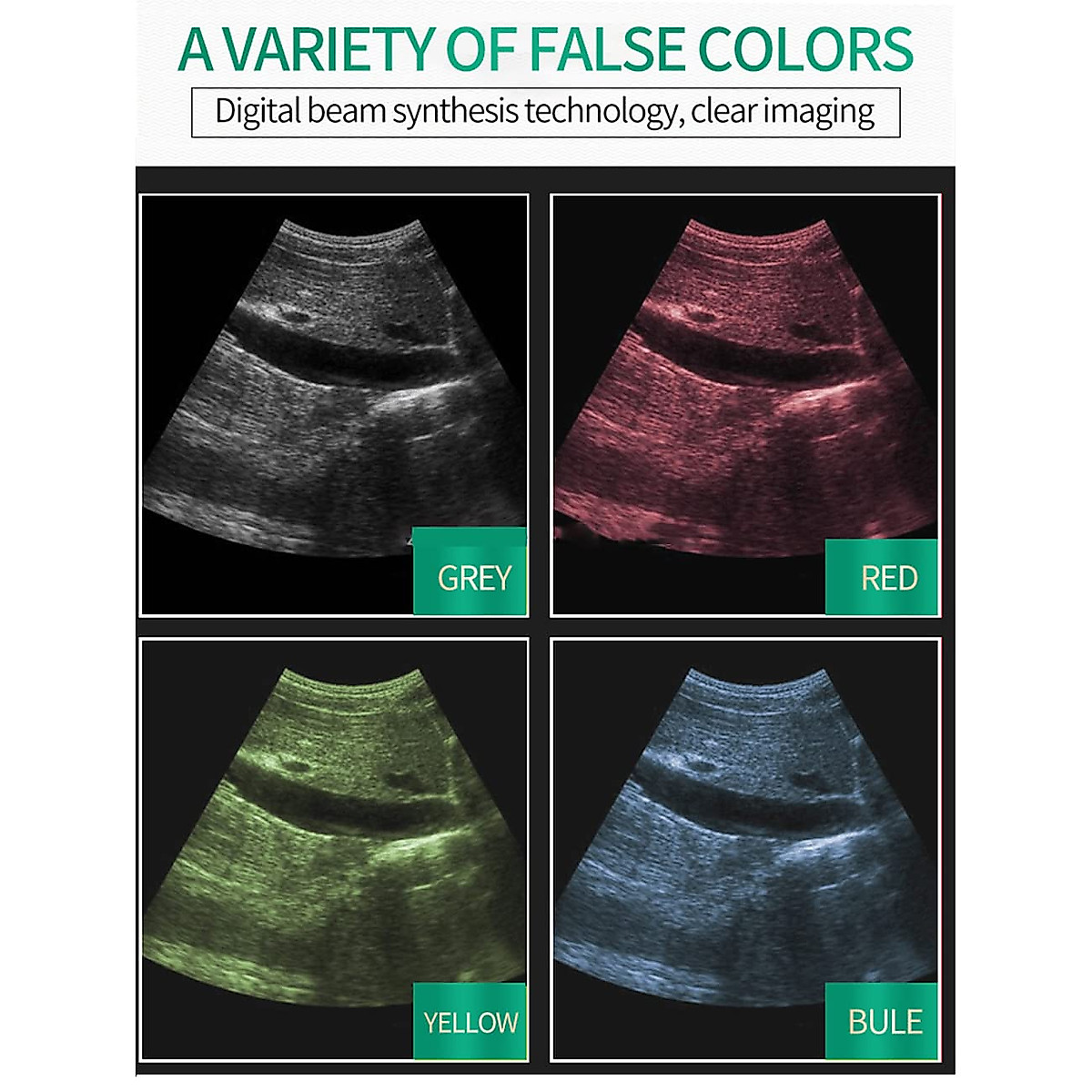 JeeKoudy Veterinary Ultrasound Scanner Machine, Handscan Vet Smart B-Ultrasound Machine Rechargeable Machine for Pig Horse Cow Pregnancy Animals Pets