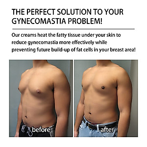 SoliPac Gynecomastia Tightening Ginger Cream (1PCS)