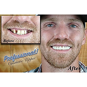 Professional Cosmetic Upper - New from Instant Smile! Hand Crafted Detail, Custom fit at Home! Works Best in Medium to Large Sized Mouths.