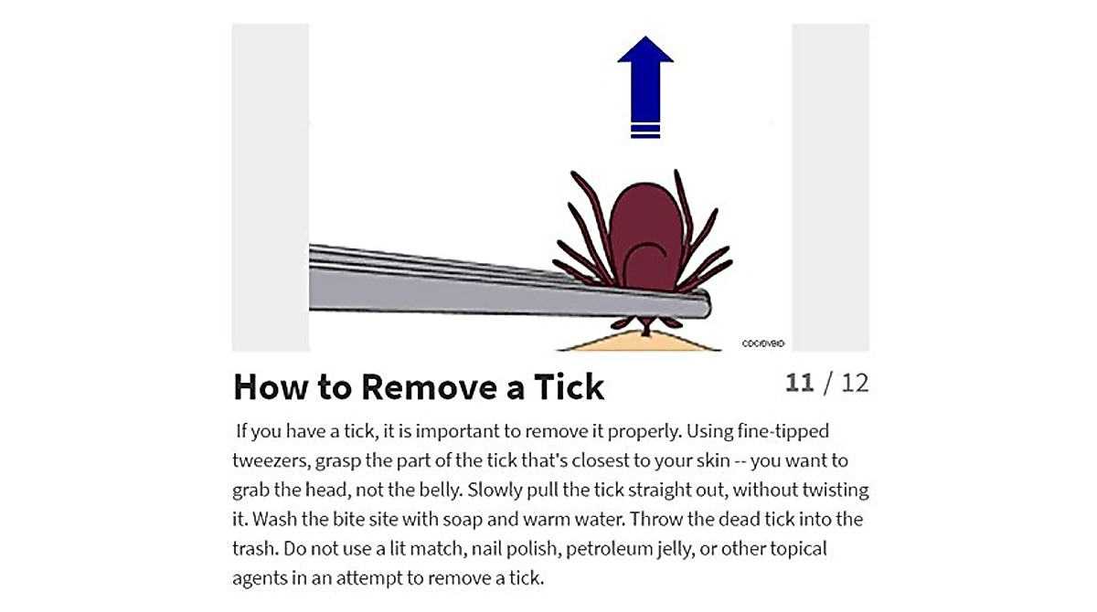 eTradewinds Tick Remover Tool Kit - Safe & Hygienic