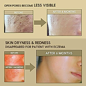 Le Revital 98% Concentrated Nano Placenta Extract, Umbilical Extract & Sodium Hyaluronate Anti-Aging Serum from Japan – Skin Rejuvenate Essence - Reduce Wrinkles, Dark Spot + Hydration – Non-greasy