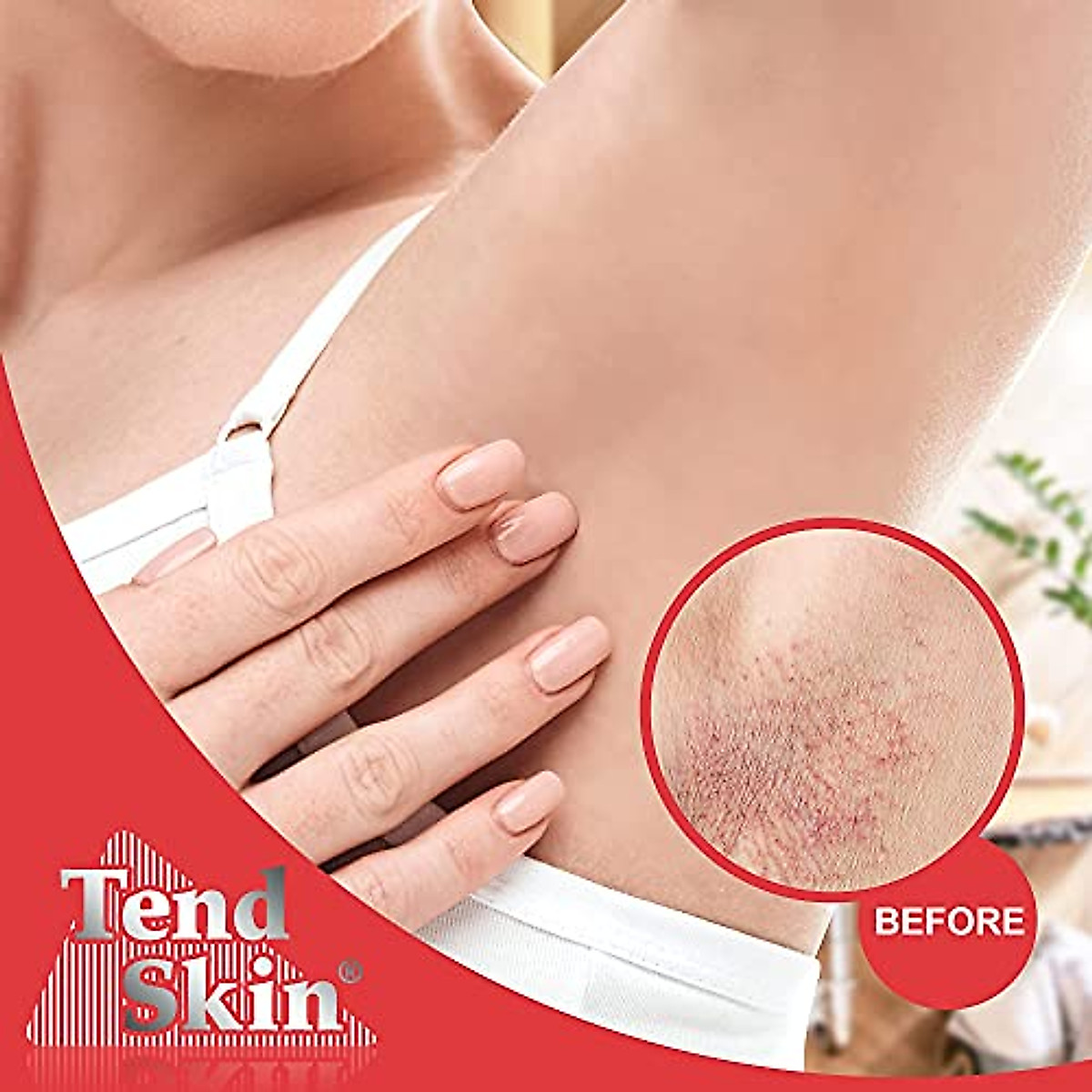 Tend Skin The Skin Care Solution For Unsightly Razor Bumps, Ingrown Hair And Razor Burns, 8 Fl Oz Bottle