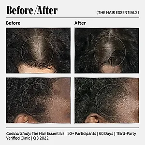 Nécessaire The Conditioner. Hyaluronic Acid + Vitamin B Complex. Fragrance-Free. Approved by the National Eczema Association.