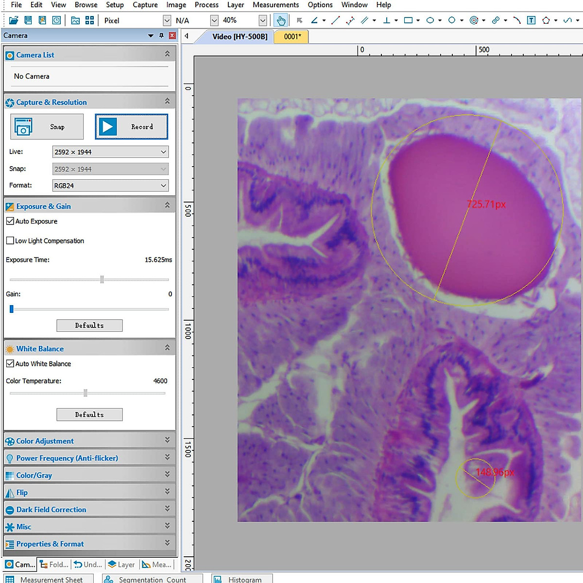 Vabiooth 5MP USB2.0 Digital Camera captures Still Images, Streams Live Videos, and is Compatible with WIN7/8/10/SP4/XP/VISTA, Mac, Linux