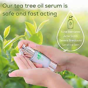 Tea Tree Oil Acne Serum - Perfect for Blemishes, Spots, Scars, Bacne, Pimples, Blackheads, Whiteheads with Natural & Organic Ingredients - by Keeva Organics