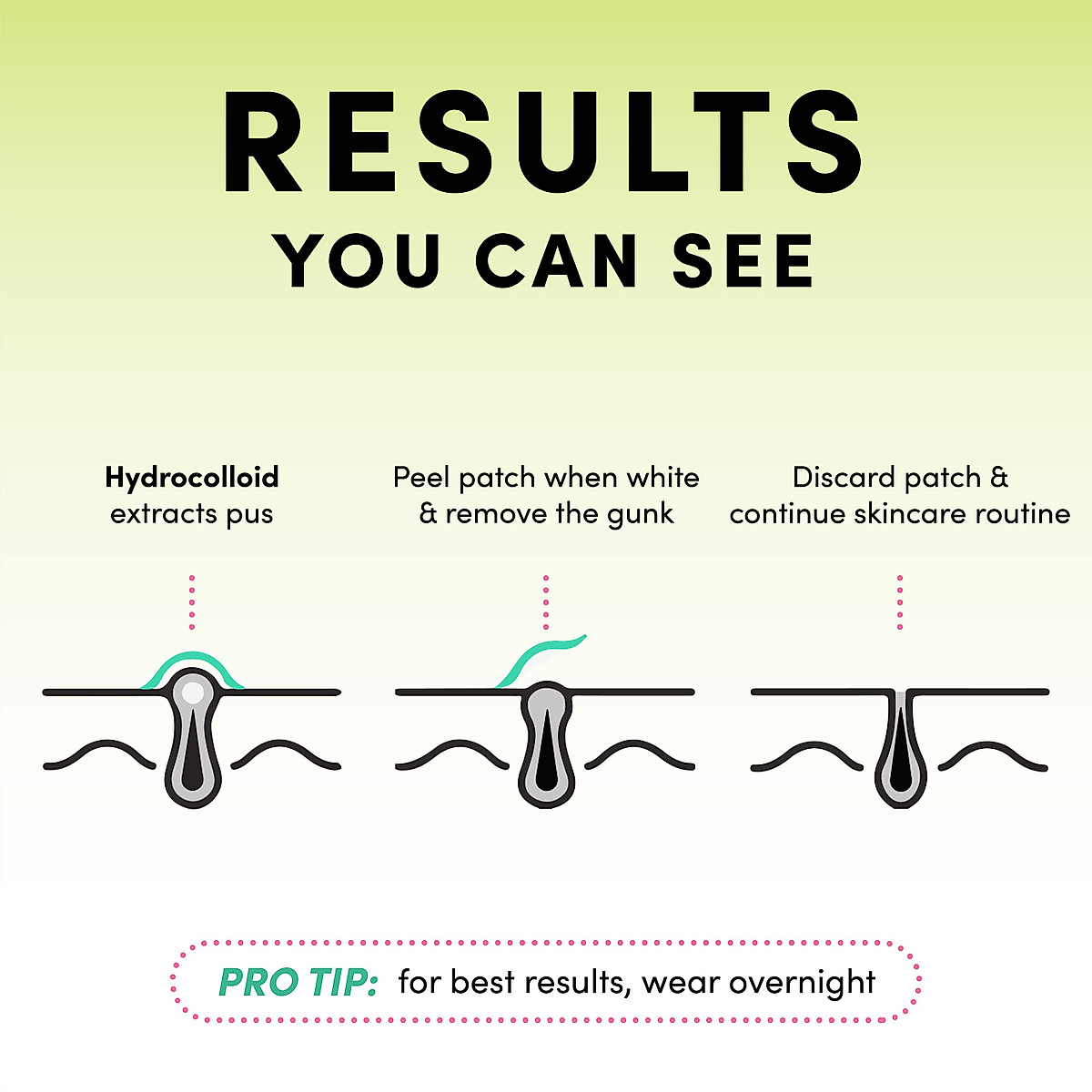 Dots for Spots Pimple Patches - Fast Acting Translucent Hydrocolloid Zit Treatment Stickers for Face - Blemish Patch for Women, Men & Teenagers - Made in Korea (60 count)