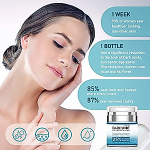 CITYGOO Dark Spot Remover for Face and Body, Dark Spot Corrector Cream, Natural Ingredient,Enriching Skin Care For All Skin Tones - Sun Spot, Melasma, Freckle Remover & Blemish Reducer-1 FL OZ