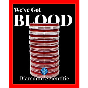 Red Blood Agar (RBA), TSA with 5% Sheep Blood (10-Pack). Pre-Poured, 15x100mm Plates. Used to Detect Hemolysis.