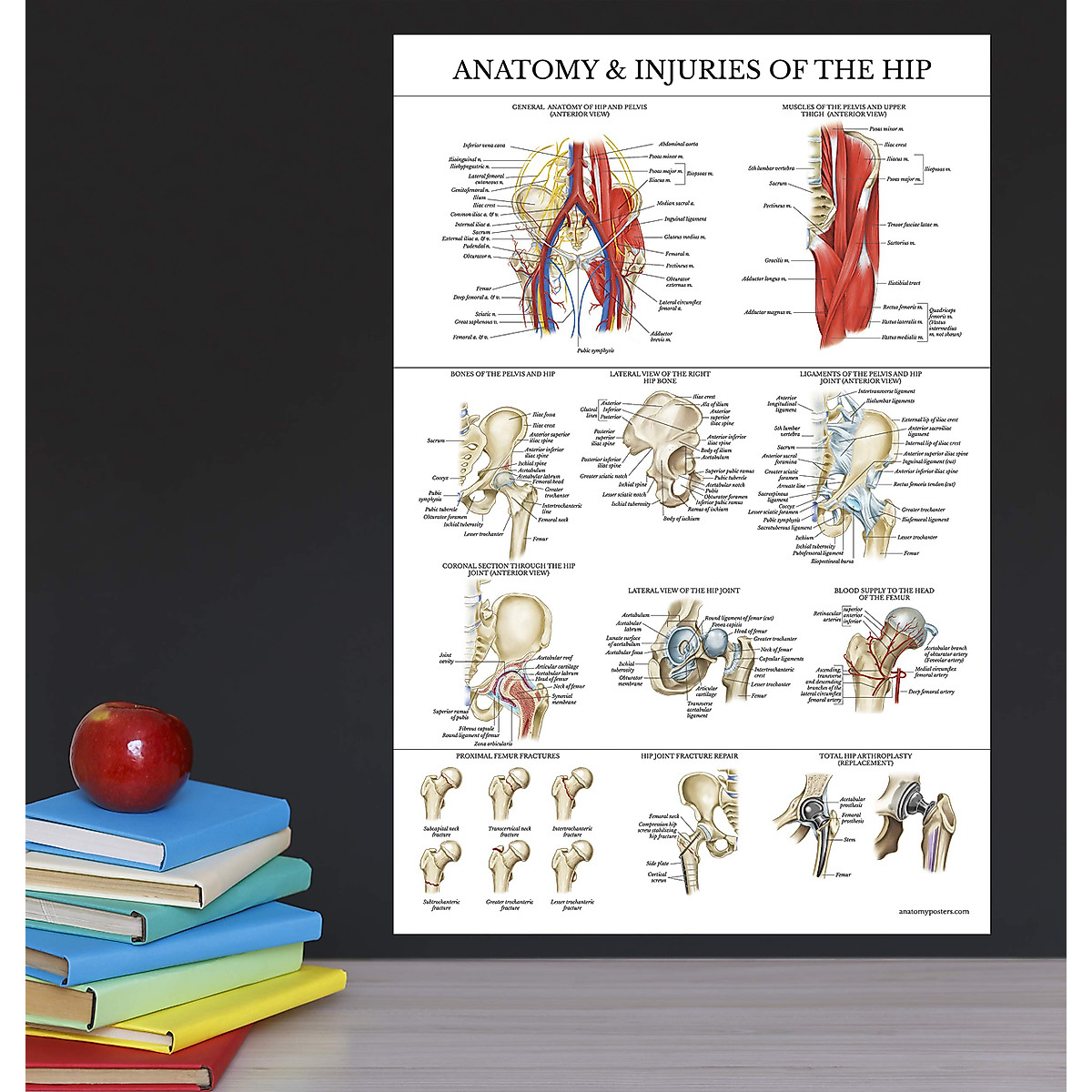 Palace Learning 2 Pack - Anatomy and Injuries of The Knee & Hip Poster Set - Anatomical Chart Set - Laminated 18" x 24"