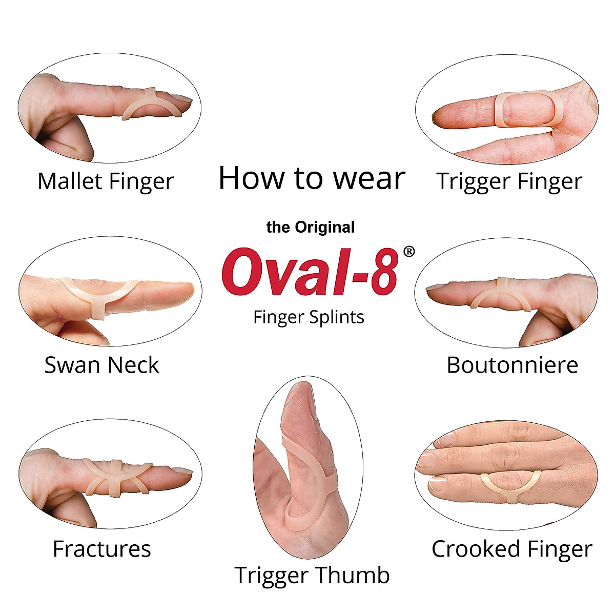 3-Point Products Oval-8 Finger Splints, The Original Finger Splint for Support and Protection for Arthritis, Trigger Finger or Thumb, and Other Finger Conditions,