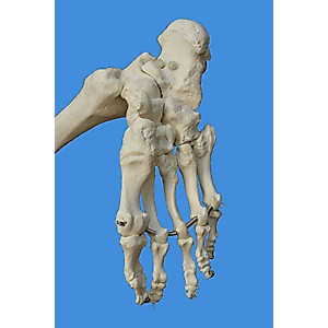 Wellden Medical Anatomical Human Lower Limb Skeleton Model, Life Size