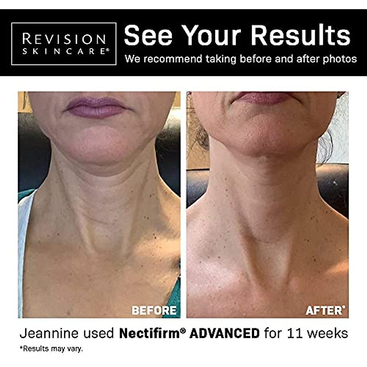 Revision Skincare Nectifirm Advanced Neck Firming Cream, 1.7 oz