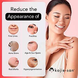 Kojie San Kojic Acid Lotion - Nourishing & Skin Brightening Body Lotion with Rosehip, Shea Butter & Vitamin E for Flawless Even Skin Tone - 150ml