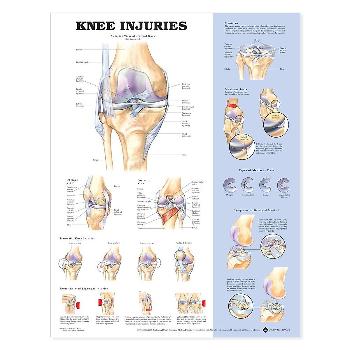 Knee Injuries Anatomical Chart