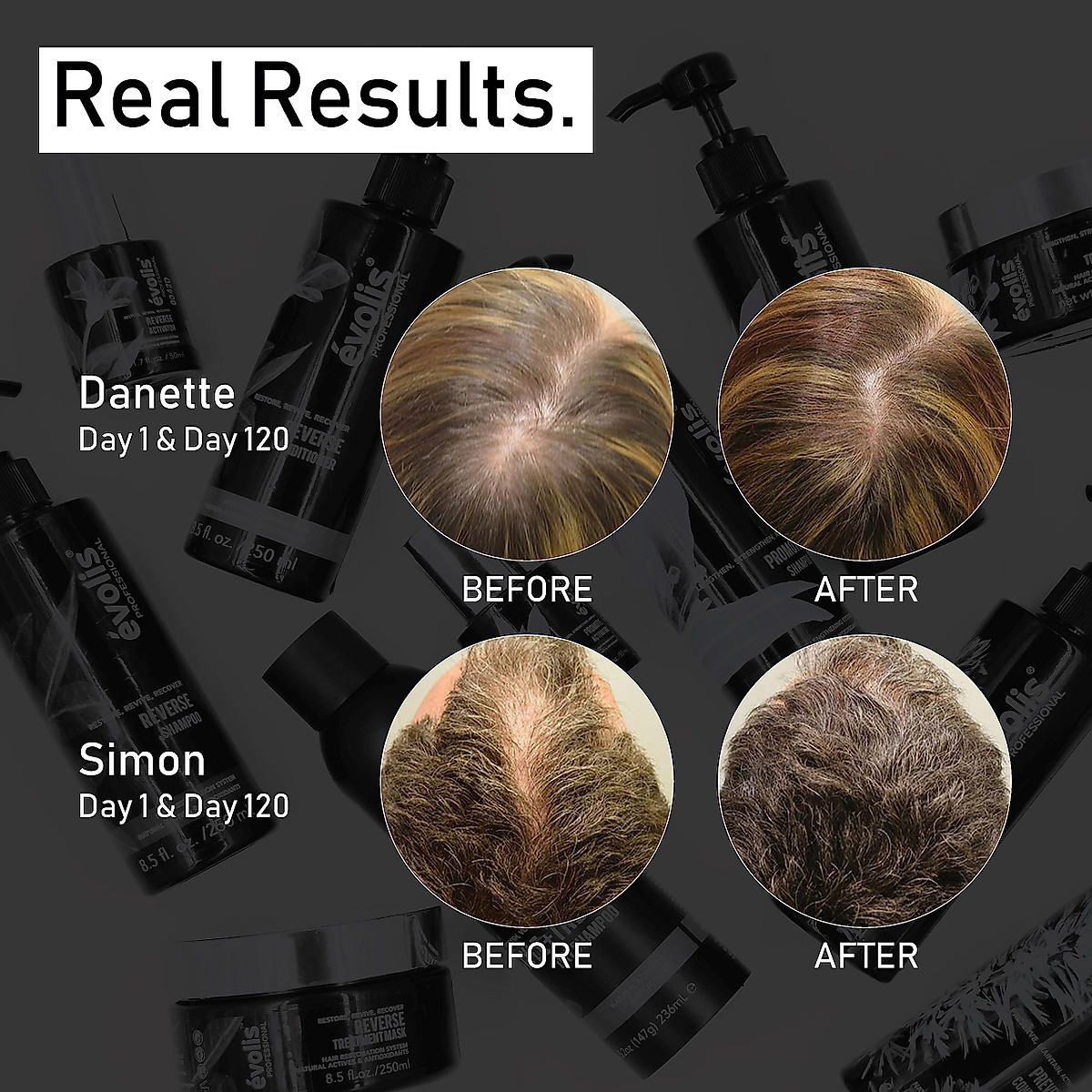 EVOLIS Reverse 3-Step System - Activator, Shampoo & Conditioner - Hair Growth Treatment for Thinning Hair - Keratin Treatment - Accelerates Growth, Thickens and Decreases Hair Fall