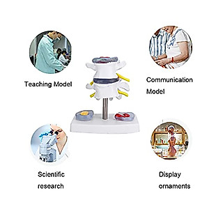 YUYTE Human Spine Model, Human Anatomical Lumbar Disc Herniation Model Human Spine School Training Supplies Excellent Way for Demonstrating Disc, Restore The Details of The Human Spine