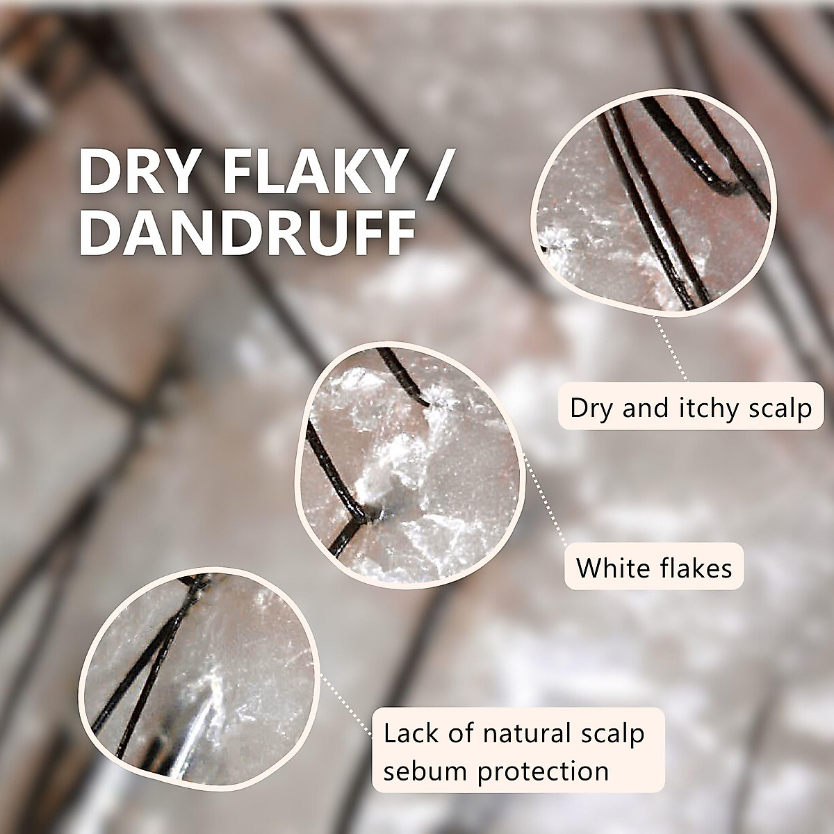 Aromase Soothing Shampoo for Dry, Itchy, and Flaky Scalps – designed to relieve scalp itchiness and provide lasting comfort gently.