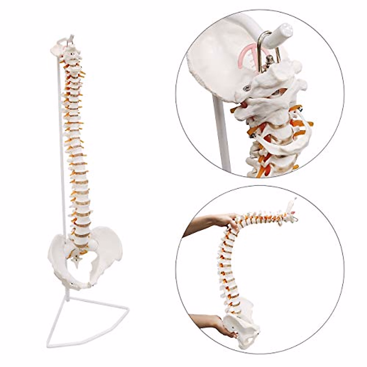 Ultrassist Life Size Human Spine Model, 34" Flexible Spinal Cord with Hyoid Bone, Herniated Disk, Nerves, Arteries and Pelvis, Teaching Tool for Medical Students and Chiropractors, Includes Stand