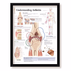 The Eye, Wall Decor Poster and Frame, Educational Art for Classrooms and Offices