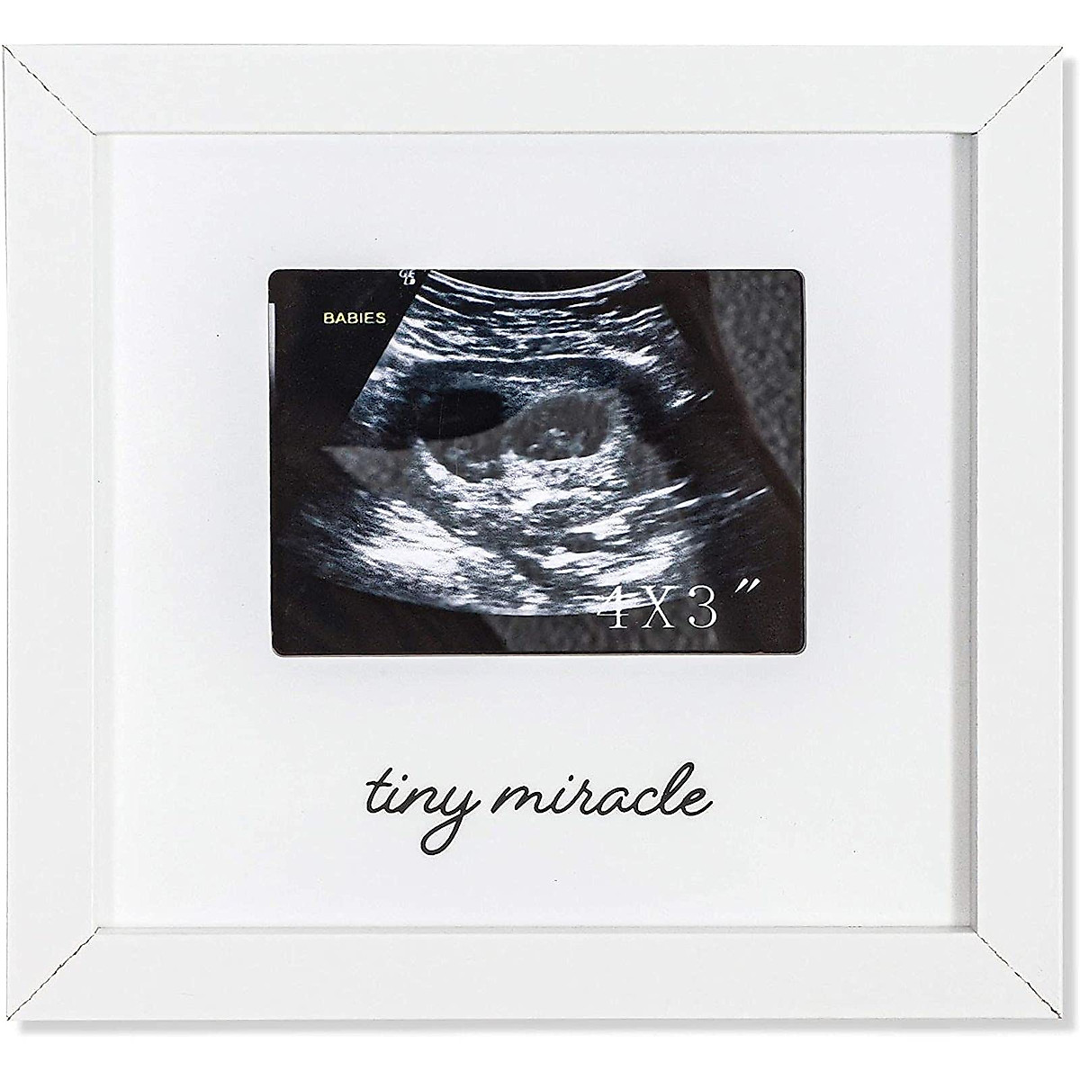 Juvale White Sonogram Keepsake Frame for 4 x 3 Ultrasound Photos (7 x 6.5 Inches)