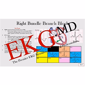 Ultimate EKG Breakdown - The EKG Guy